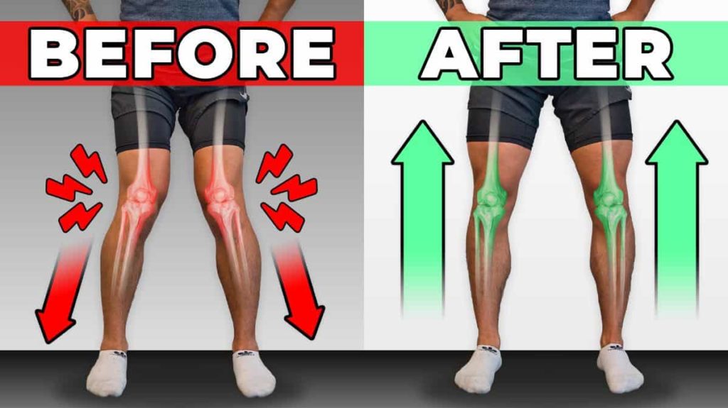 How To Unf*ck Your Knees (10-Minute Corrective Routine)